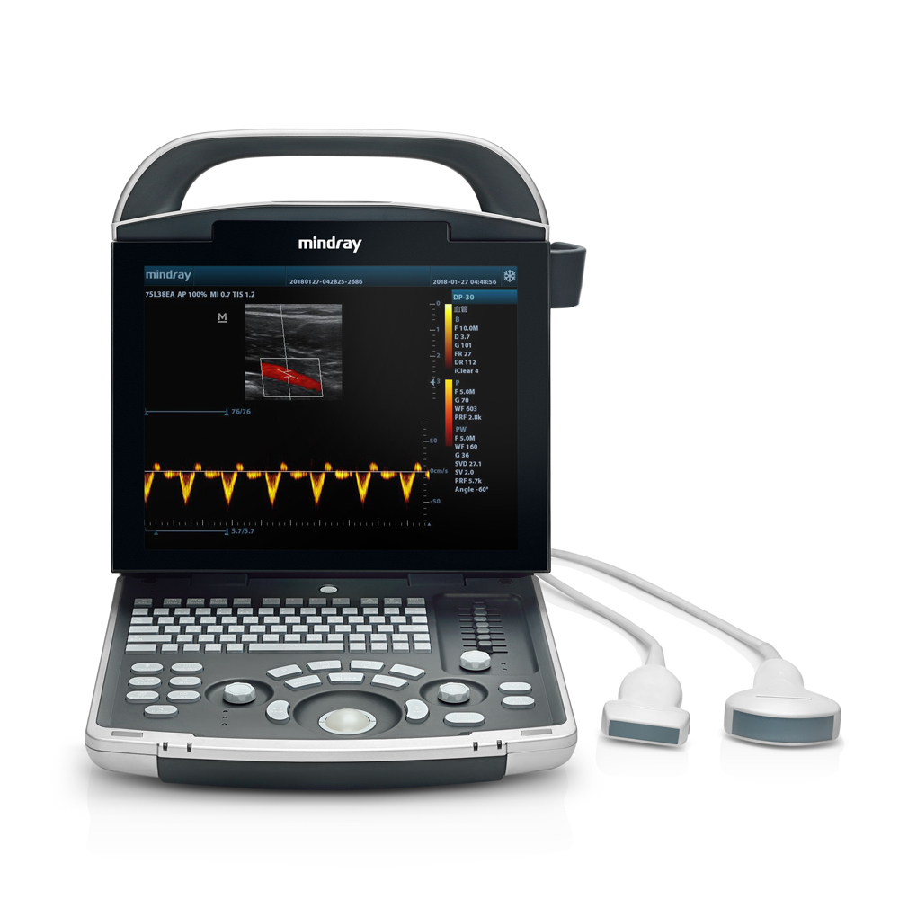 Portable Ultrasound System Archives - Rapid Medical Rapid Medical